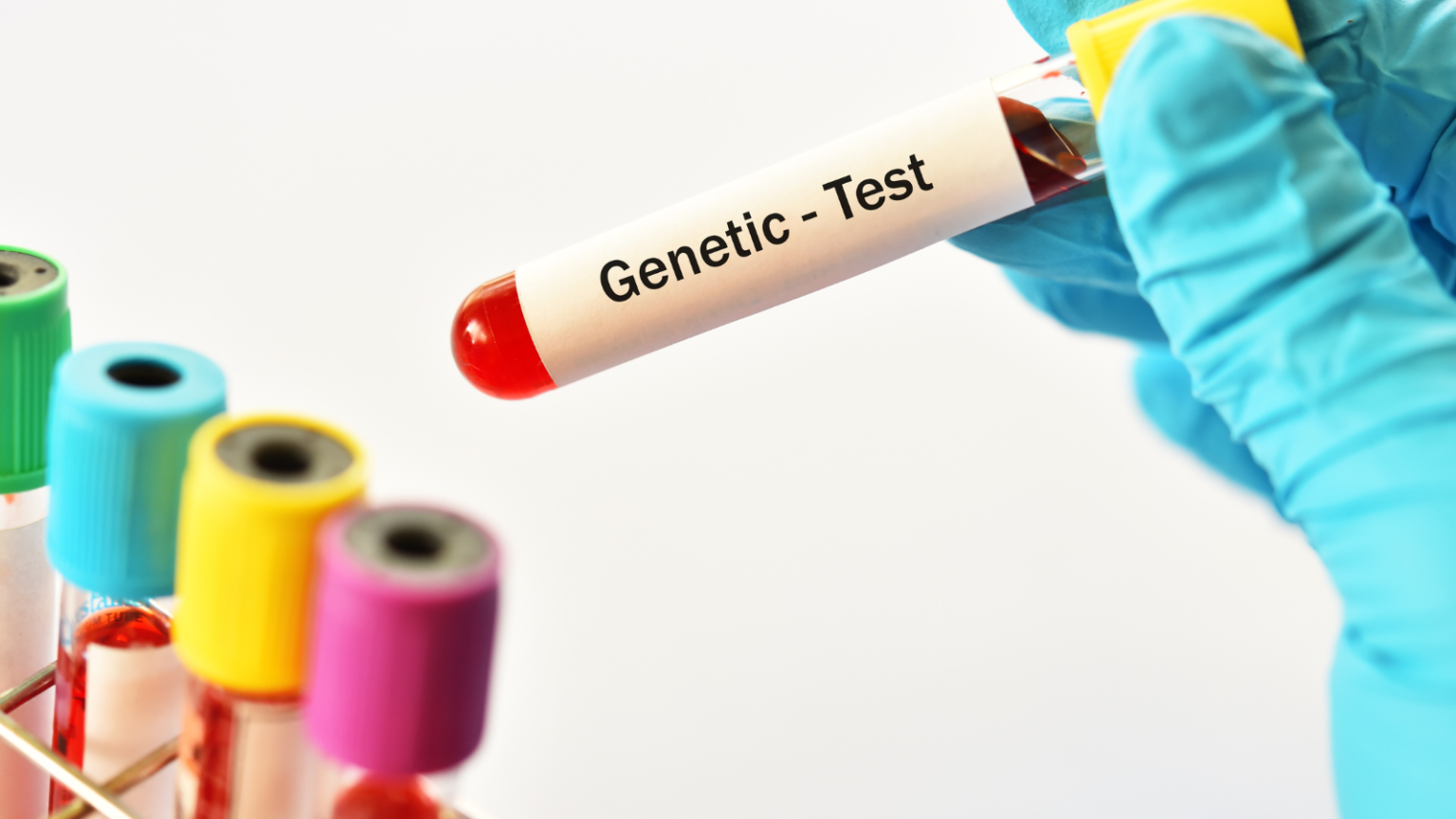 Essential Guide to Preimplantation Genetic Testing for IVF